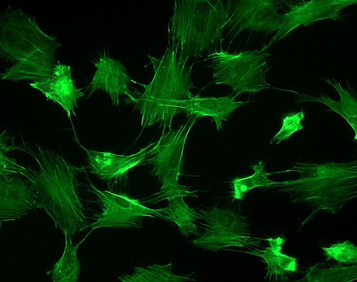 Basic Concepts: Cell Migration | Migrations